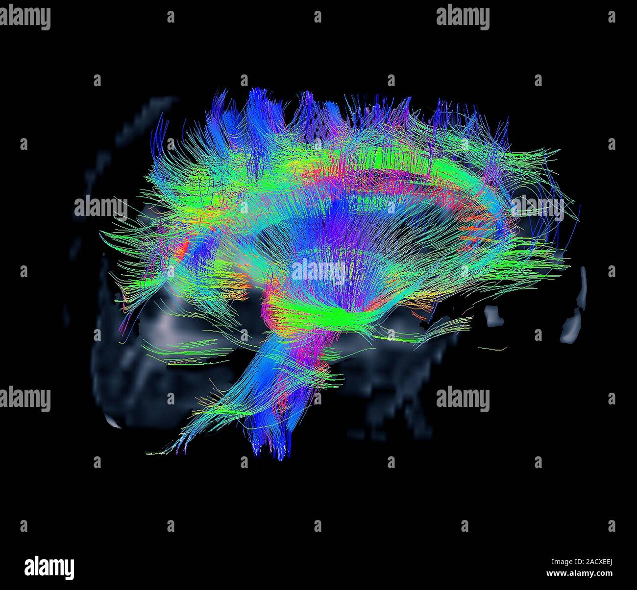 White matter fibres. Coloured diffusion tensor imaging (DTI) scan of ...