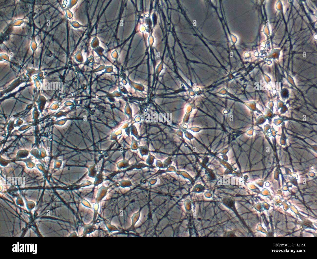 Stem cell-derived neurons, light micrograph. Stem cells derived from ...