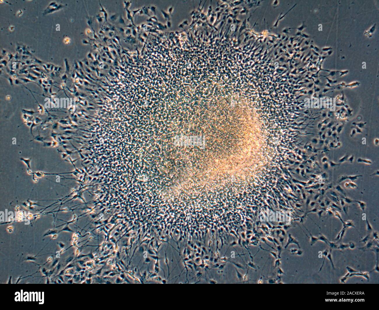 Urine-derived stem cells, light micrograph. Chinese scientists have ...
