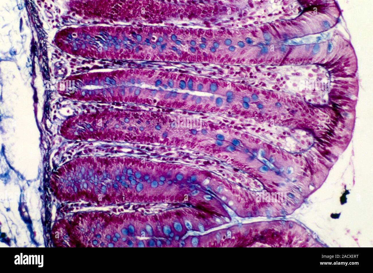 Colon lining. Light micrograph of a section of the lining (mucosa) of ...