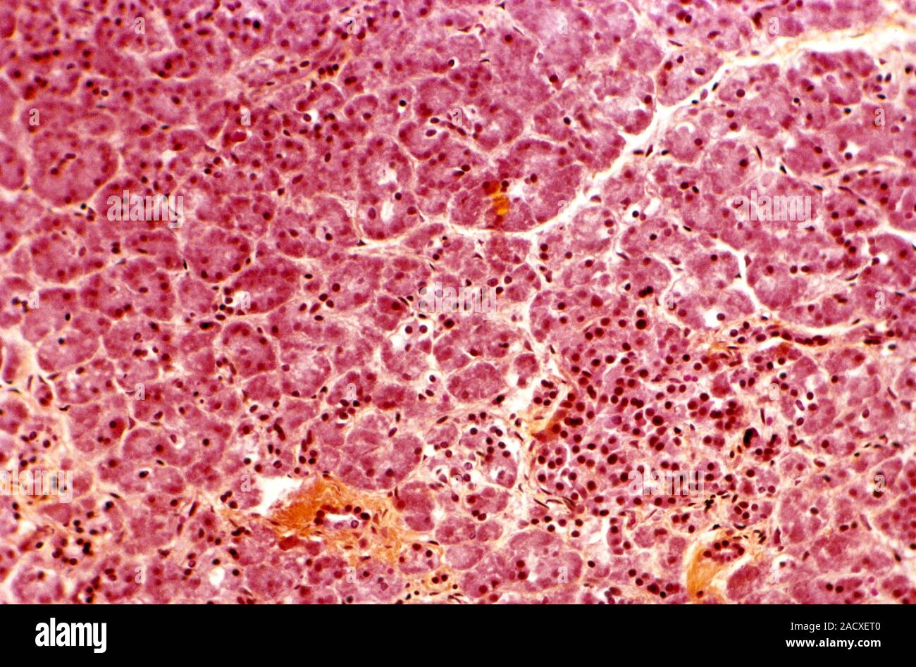 Light micrograph of a section through the pancreas. The pancreas ...