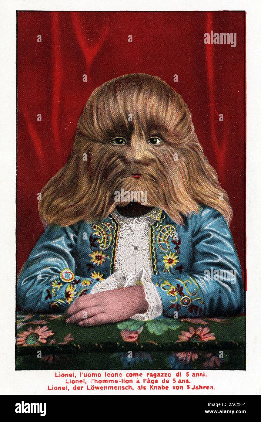 Lionel The Lion Faced Man Lionel The Lion Faced Man