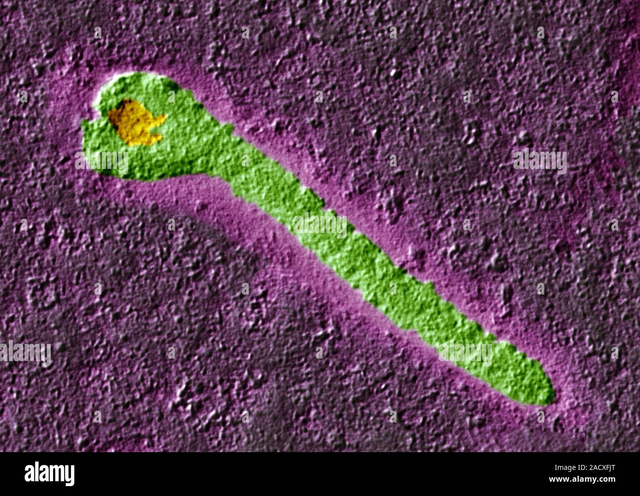 Ebola virus particles, coloured transmission electron micrograph (TEM ...