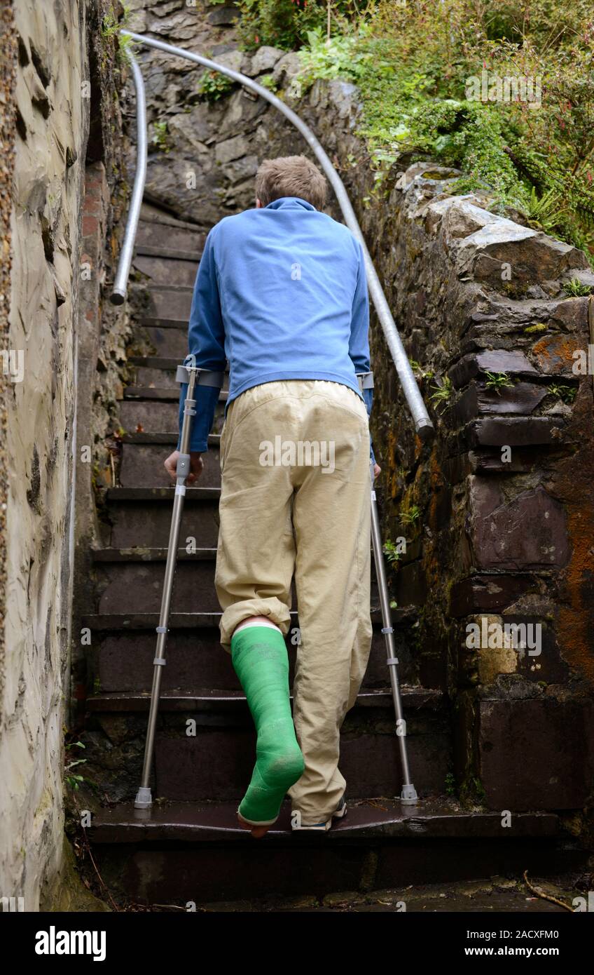 Climbing steep steps on crutches, with a fractured tibia immobilised in ...