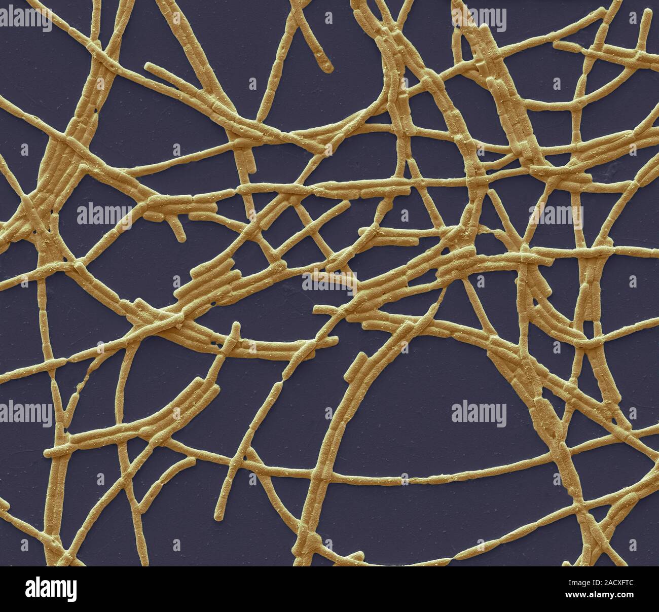 Anthrax bacteria. Coloured scanning electron micrograph (SEM) of ...