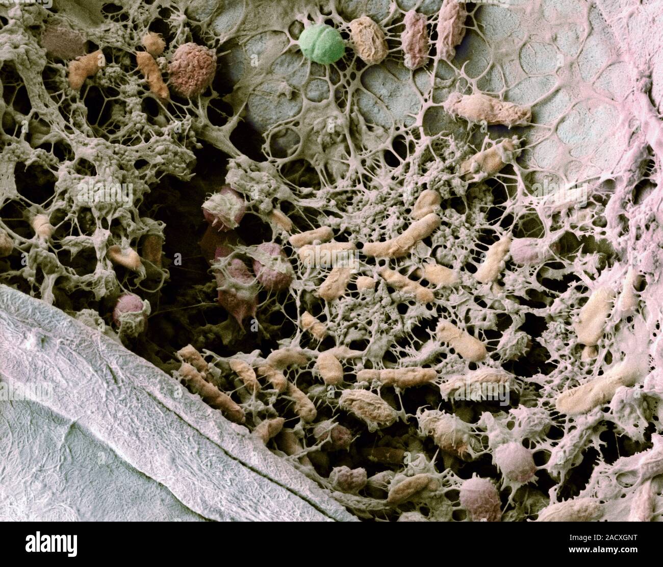 Biofilm on a cotton swab, coloured scanning electron micrograph (SEM ...