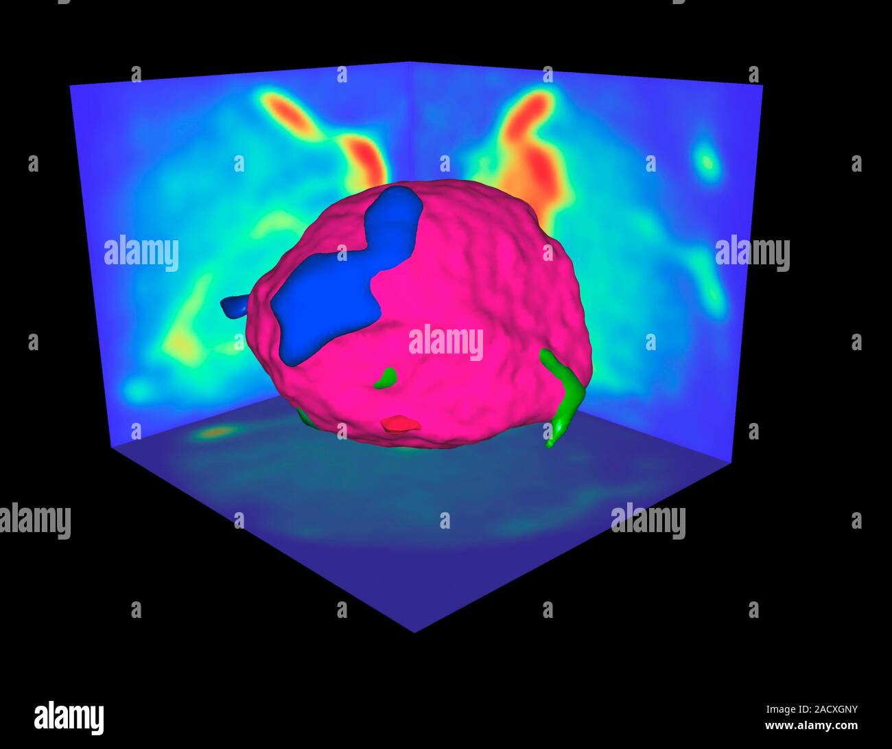 Sample of aluminium alloy, atom probe tomography. This image shows zinc ...