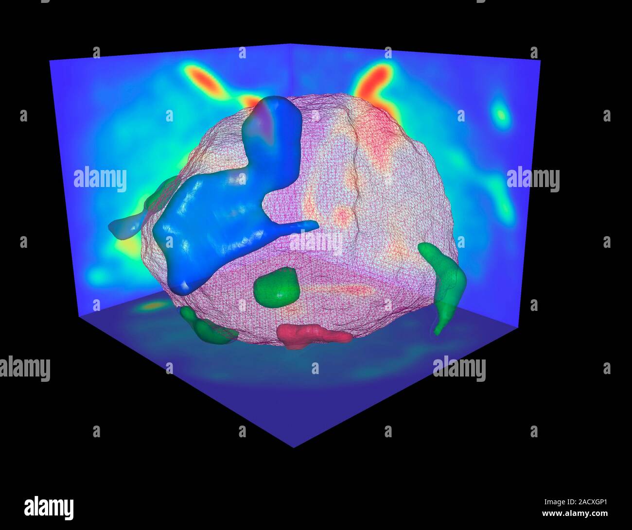 Sample of aluminium alloy, atom probe tomography. This image shows zinc ...
