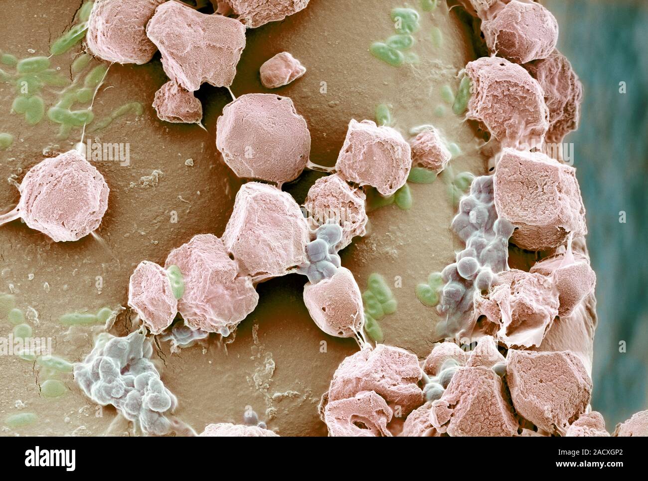 Kitchen sponge, coloured scanning electron micrograph (SEM). Crystals ...