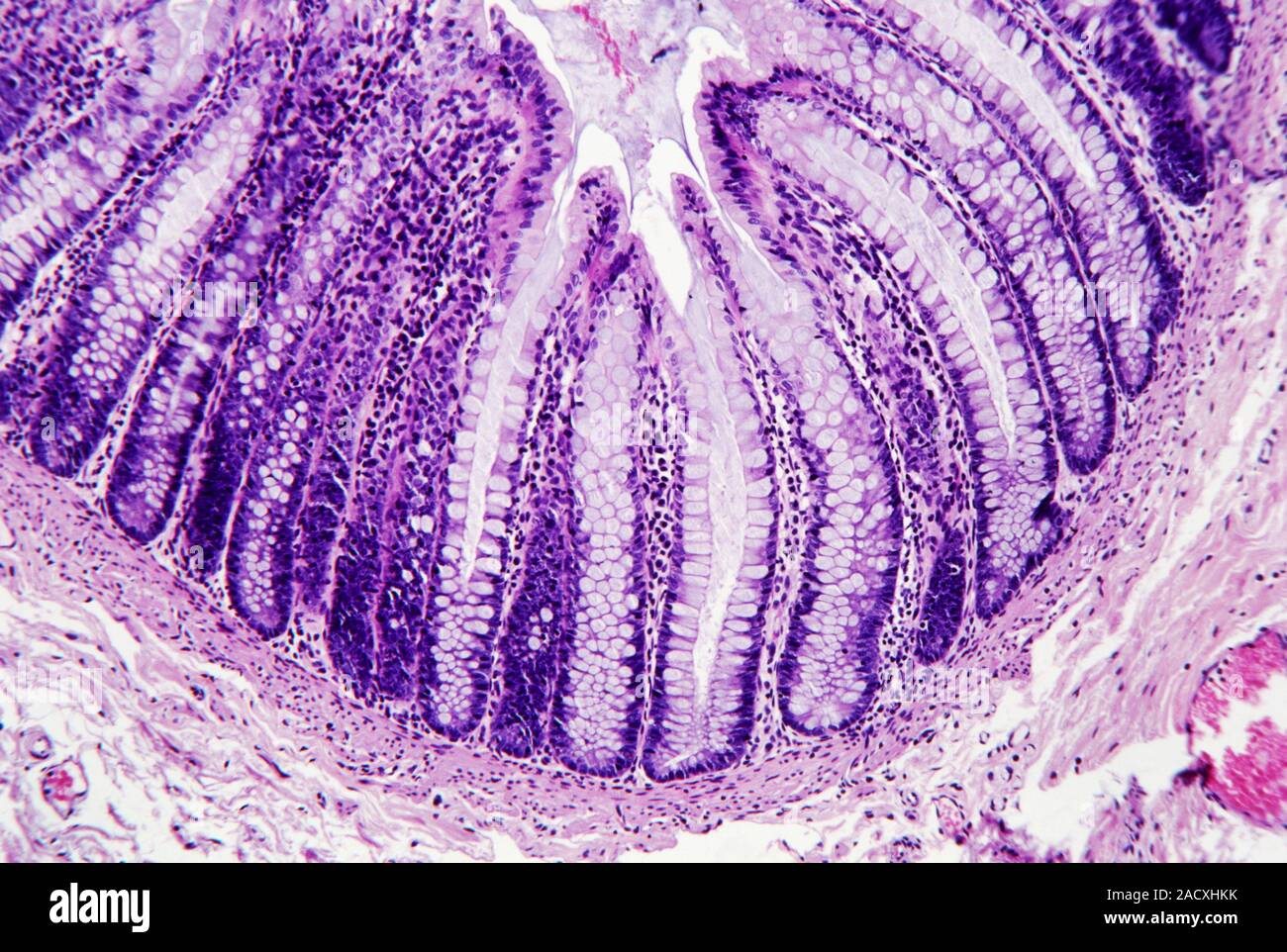 Large intestine lining. Light micrograph of a section through the ...