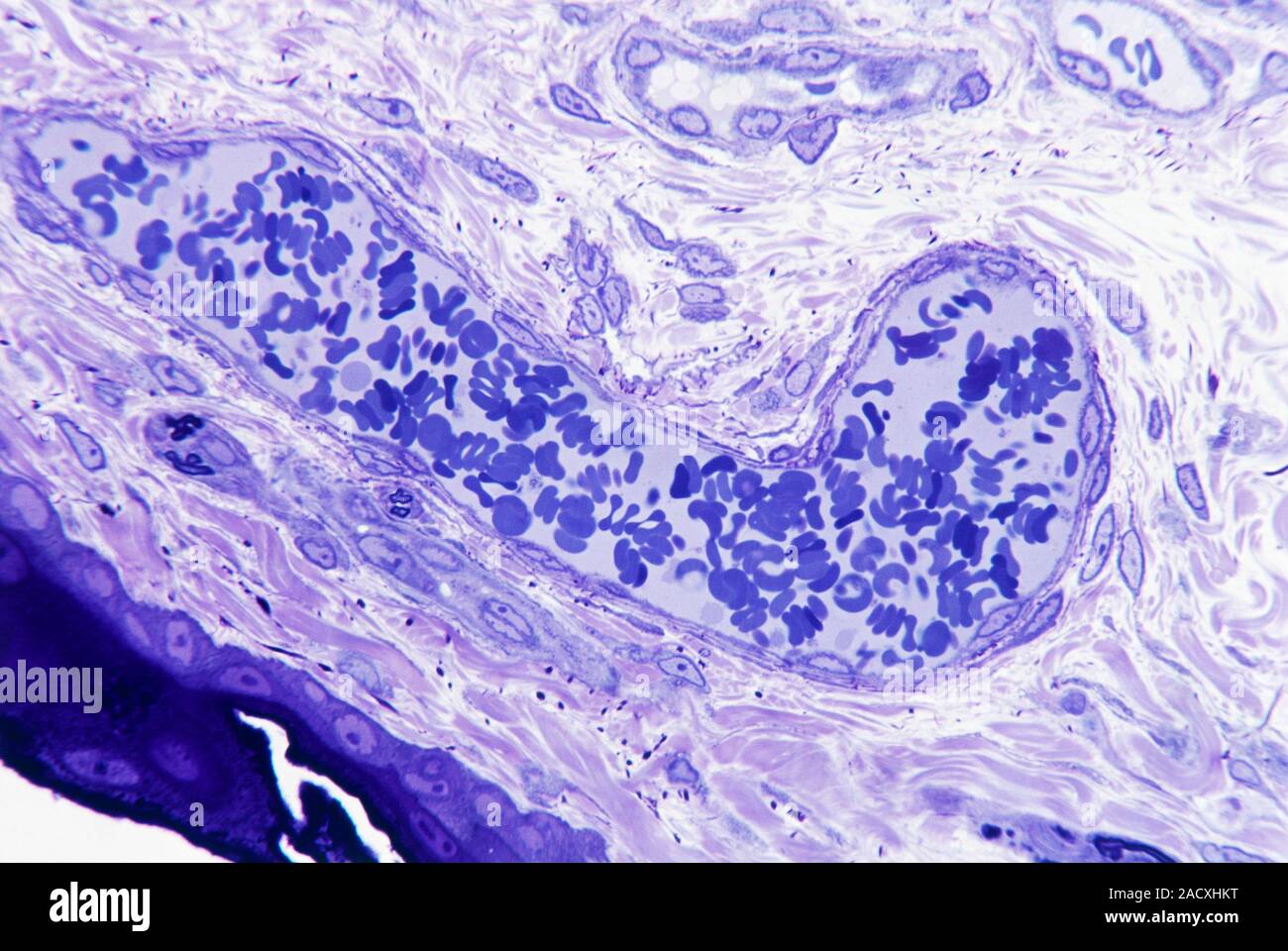 Venule. Light micrograph of a section through a venule, part of the ...