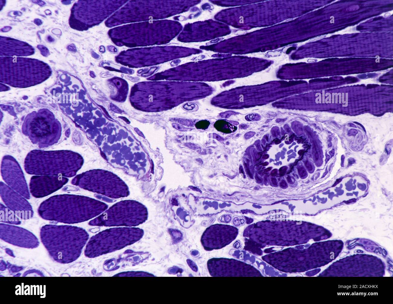 Blood vessels. Light micrograph of a section through an arteriole ...