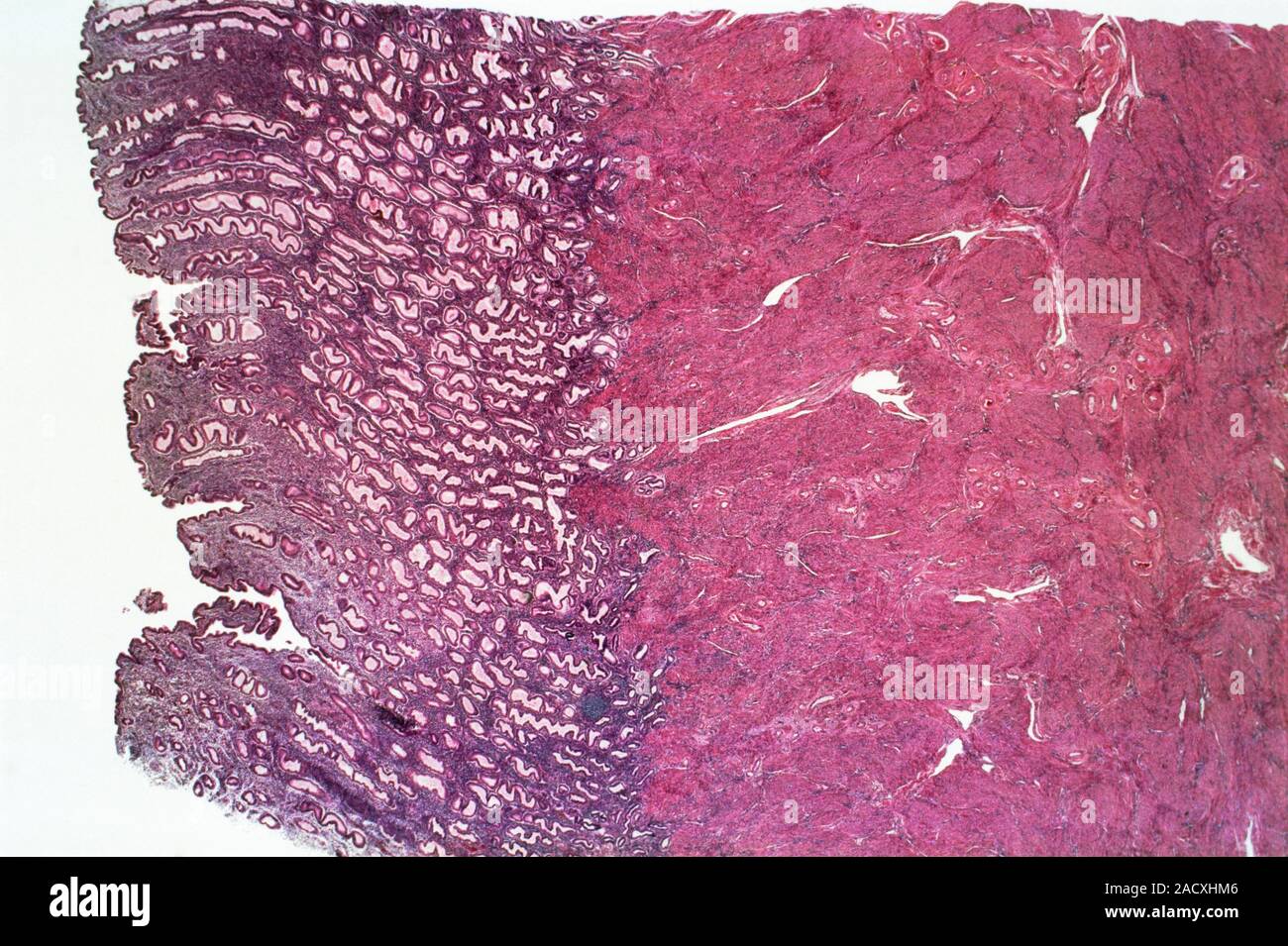 Uterus lining. Light micrograph of a section through the endometrium ...