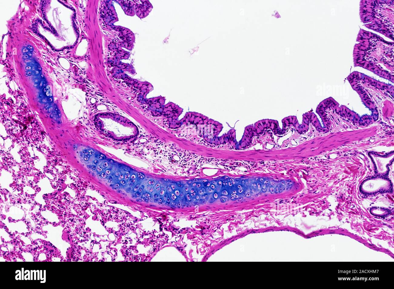 Lung bronchus. Light micrograph of a section through lung tissue and a ...