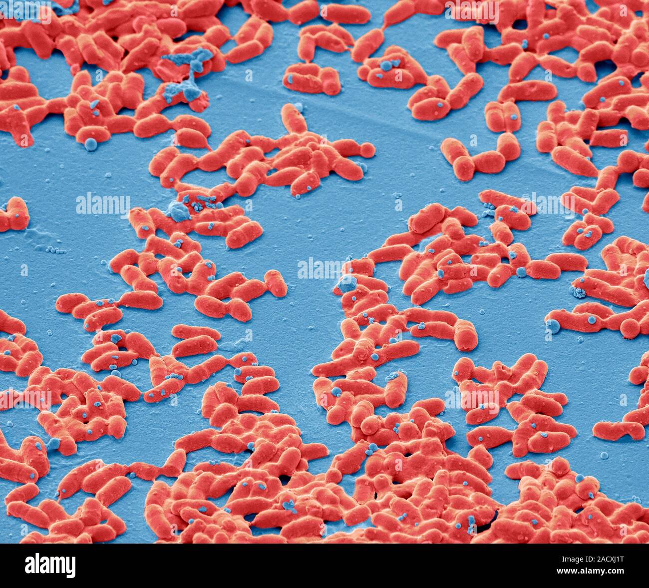 Corynebacterium diphtheriae, Coloured scanning electron micrograph (SEM ...