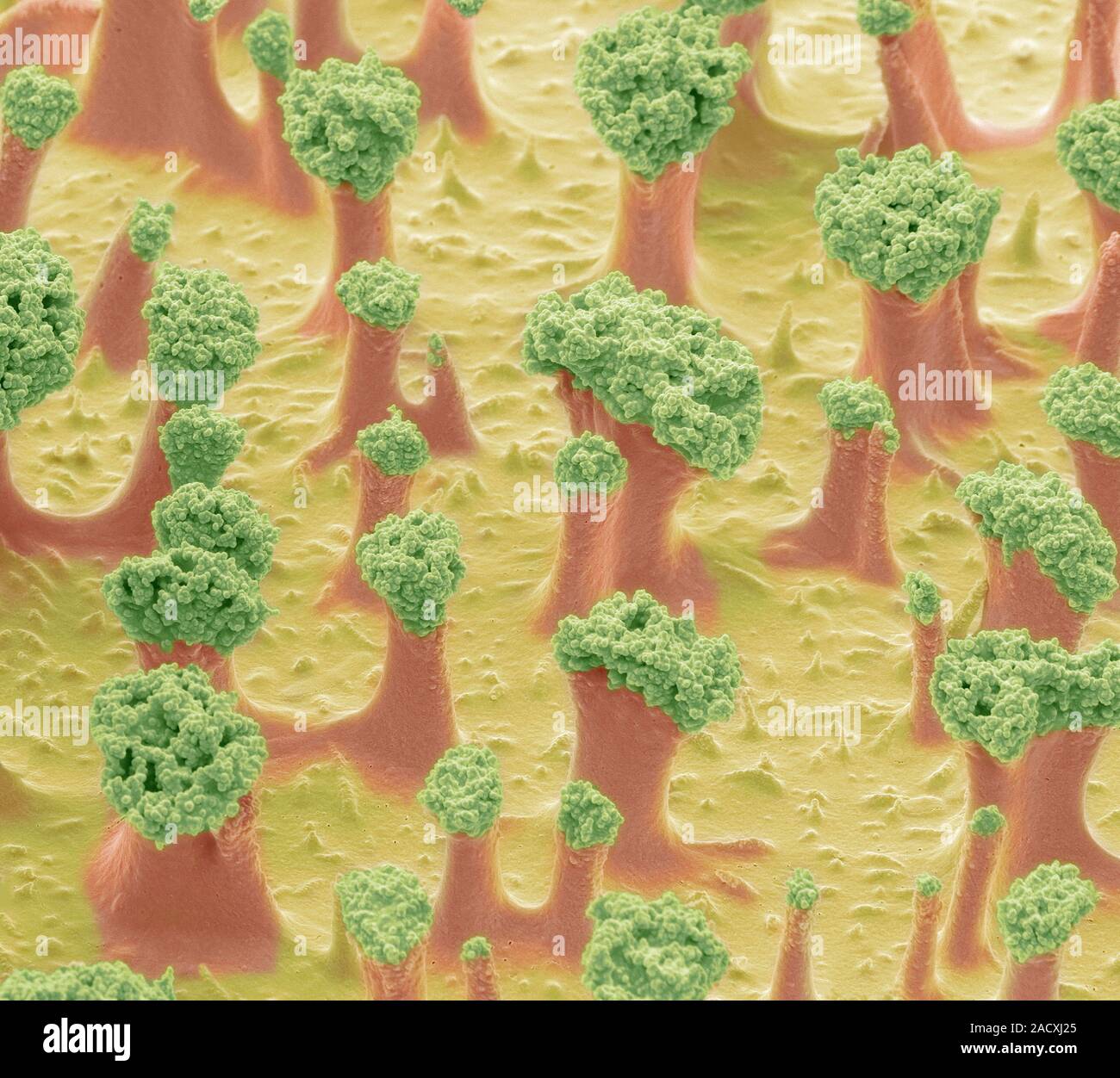 Stink bug egg detail, Coloured scanning electron micrograph (SEM ...