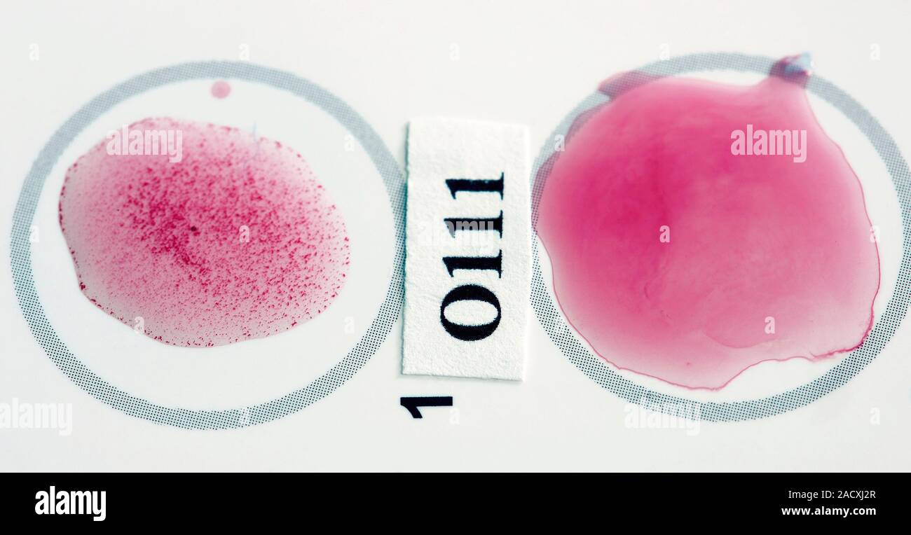 E. coli STEC bacterial test. Results of a test for the O111 serogroup ...