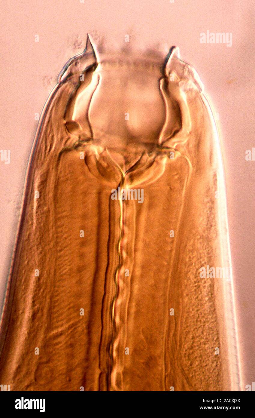 Nematode mouthpart, light micrograph. Nematodes are small unsegmented ...