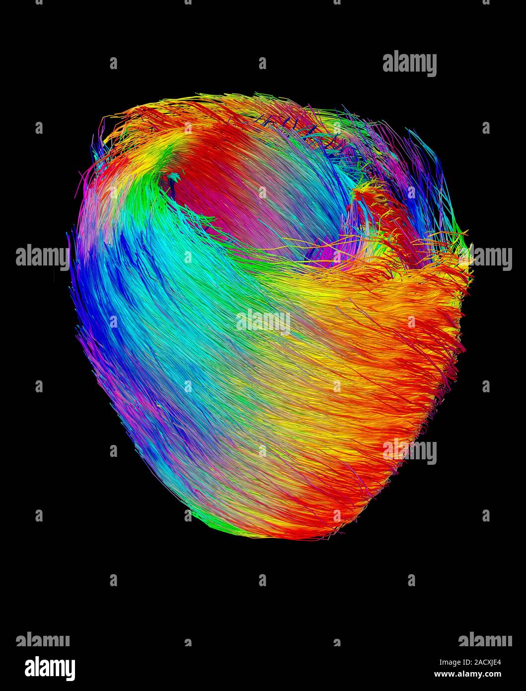 Heart muscle fibres. Coloured diffusion tensor imaging (DTI) scan of a ...