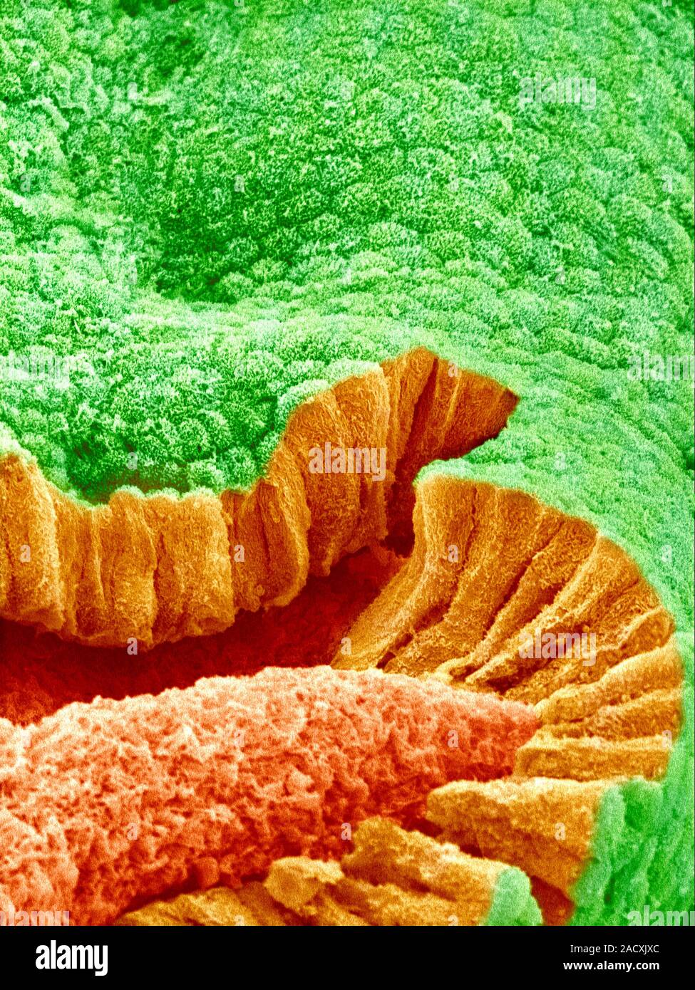 Gallbladder surface. Coloured scanning electron micrograph (SEM) of a ...