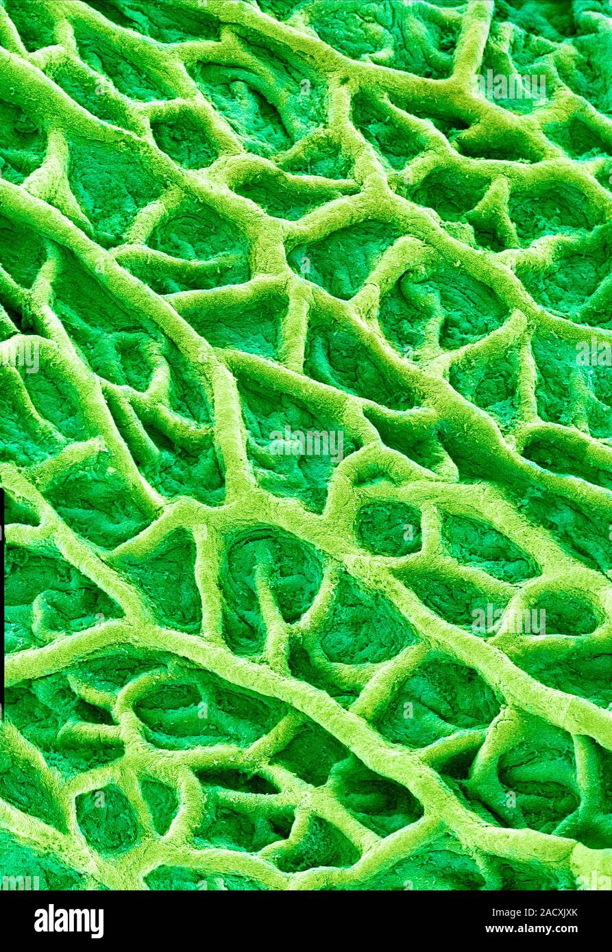 Gallbladder surface, coloured scanning electron micrograph (SEM). The ...
