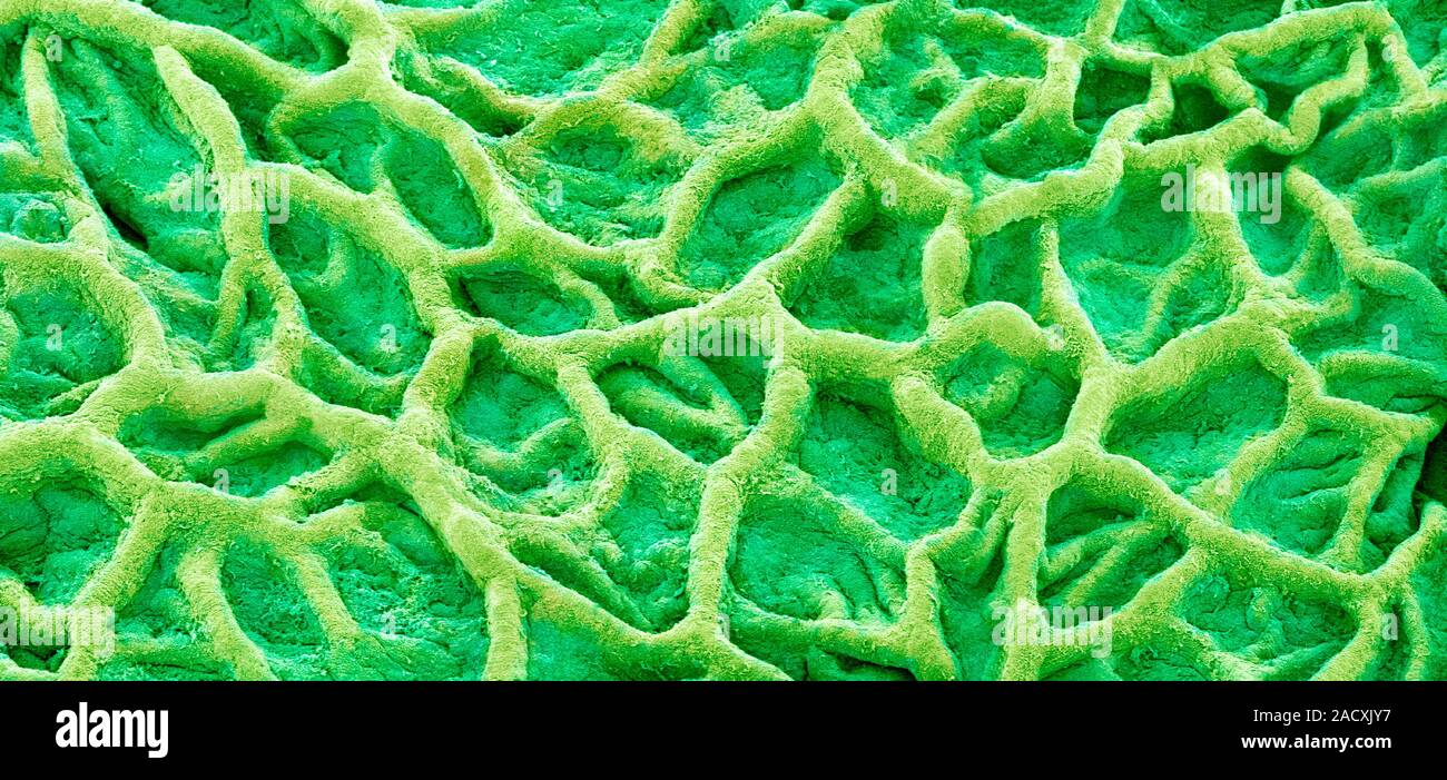 Gallbladder surface, coloured scanning electron micrograph (SEM). The ...