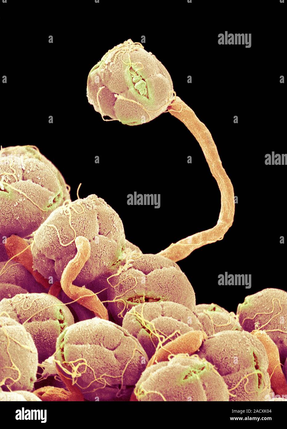 Azalea (Rhododendron sp.) pollen, coloured scanning electron micrograph ...