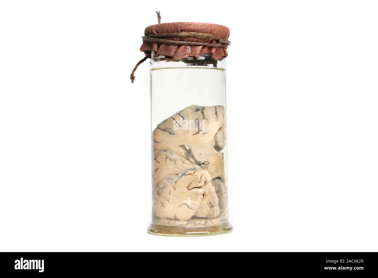 A brain preserved in a jar. 19th century museum specimen Stock Photo ...