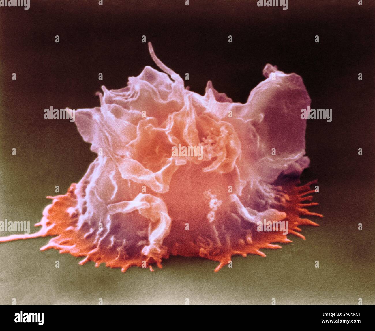Monocyte white blood cell. Scanning electron micrograph (SEM) of a ...