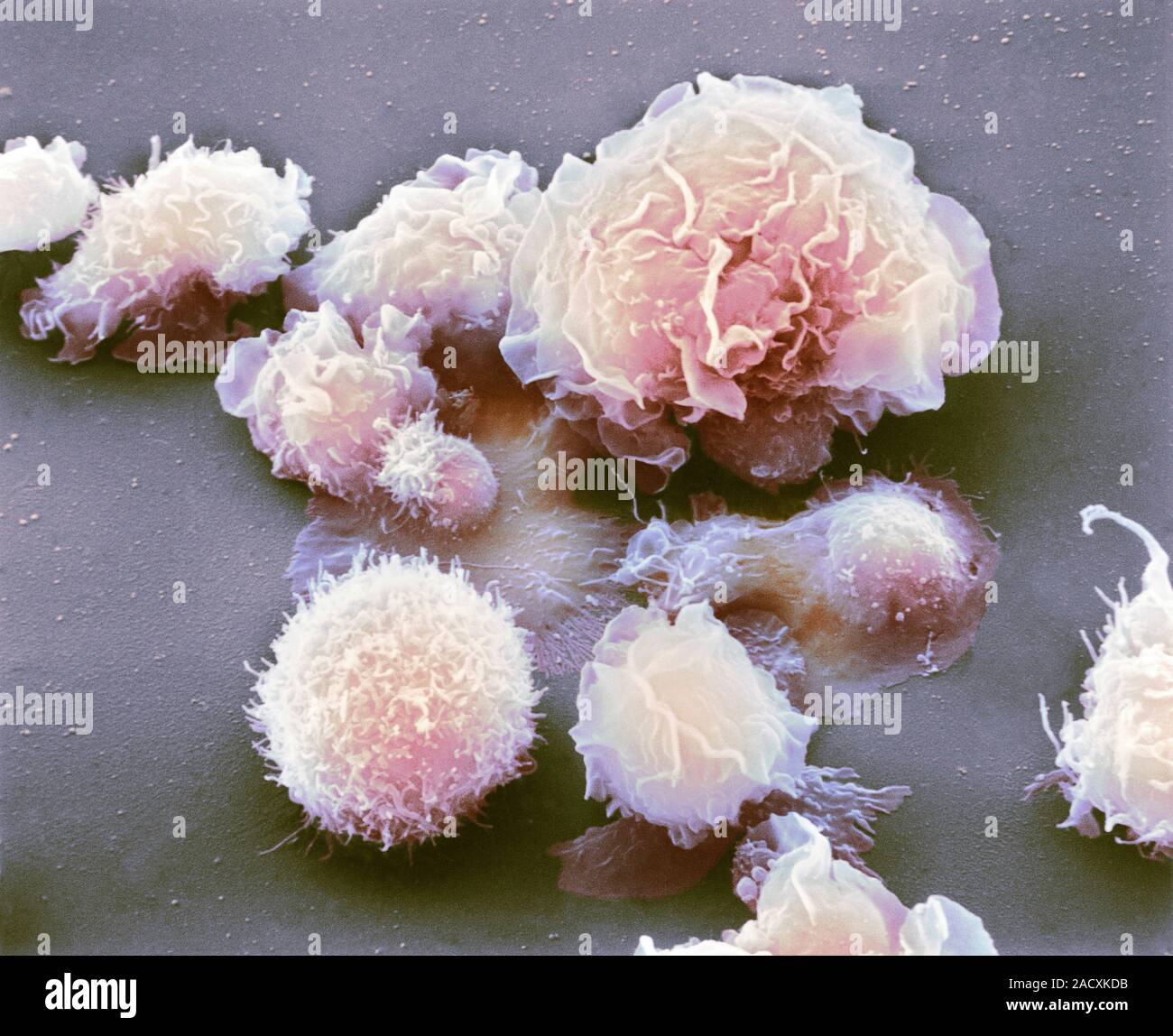 Monocyte white blood cells. Scanning electron micrograph (SEM) of ...