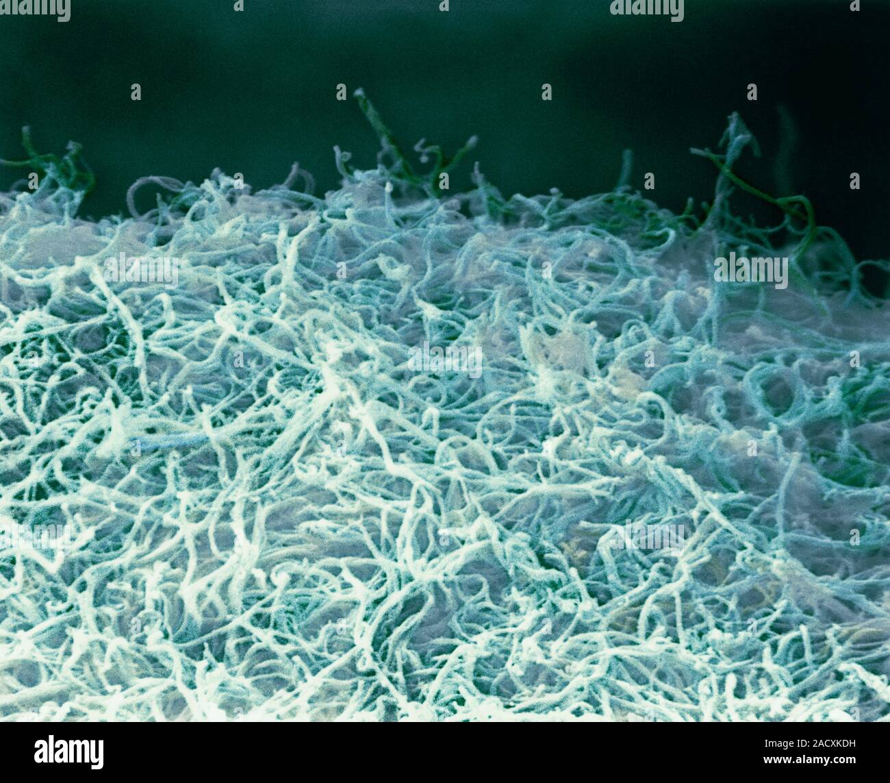 Fibrin mesh. Coloured scanning electron micrograph (SEM) of a mesh of ...