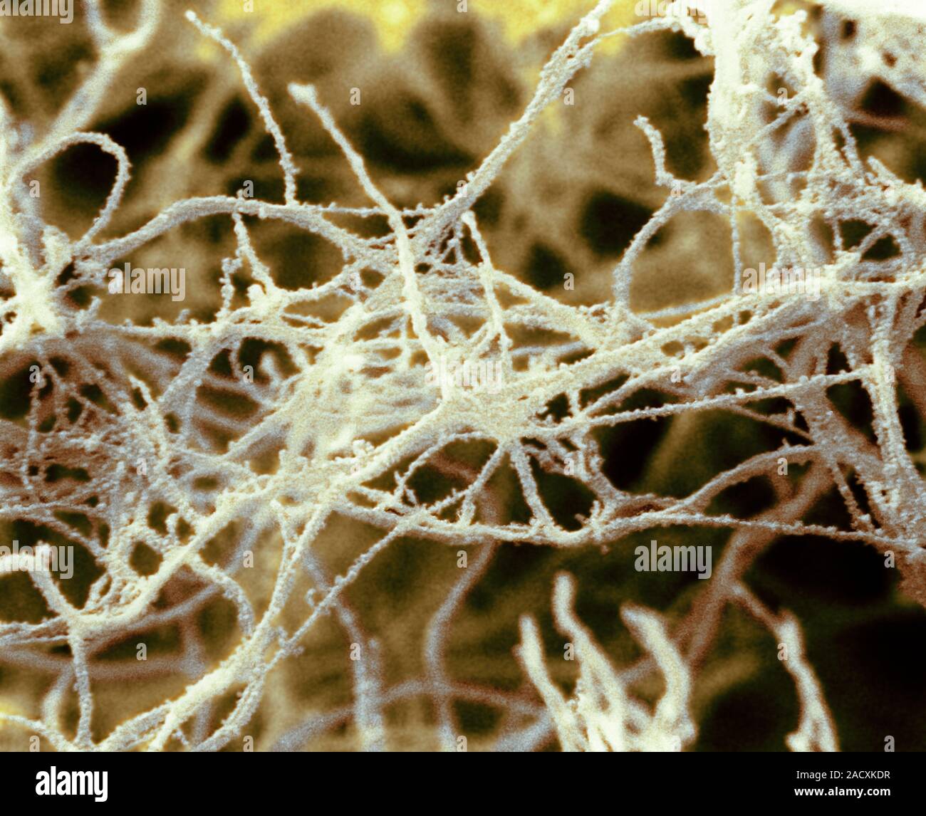 Fibrin mesh. Coloured scanning electron micrograph (SEM) of a mesh of ...