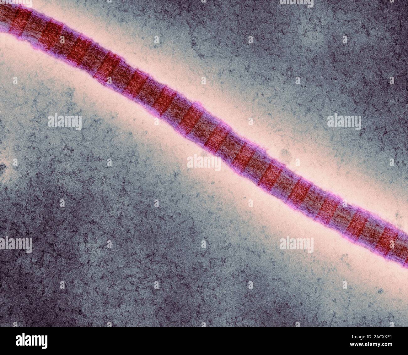 Collagen fibril. Coloured scanning electron micrograph (SEM) of a ...