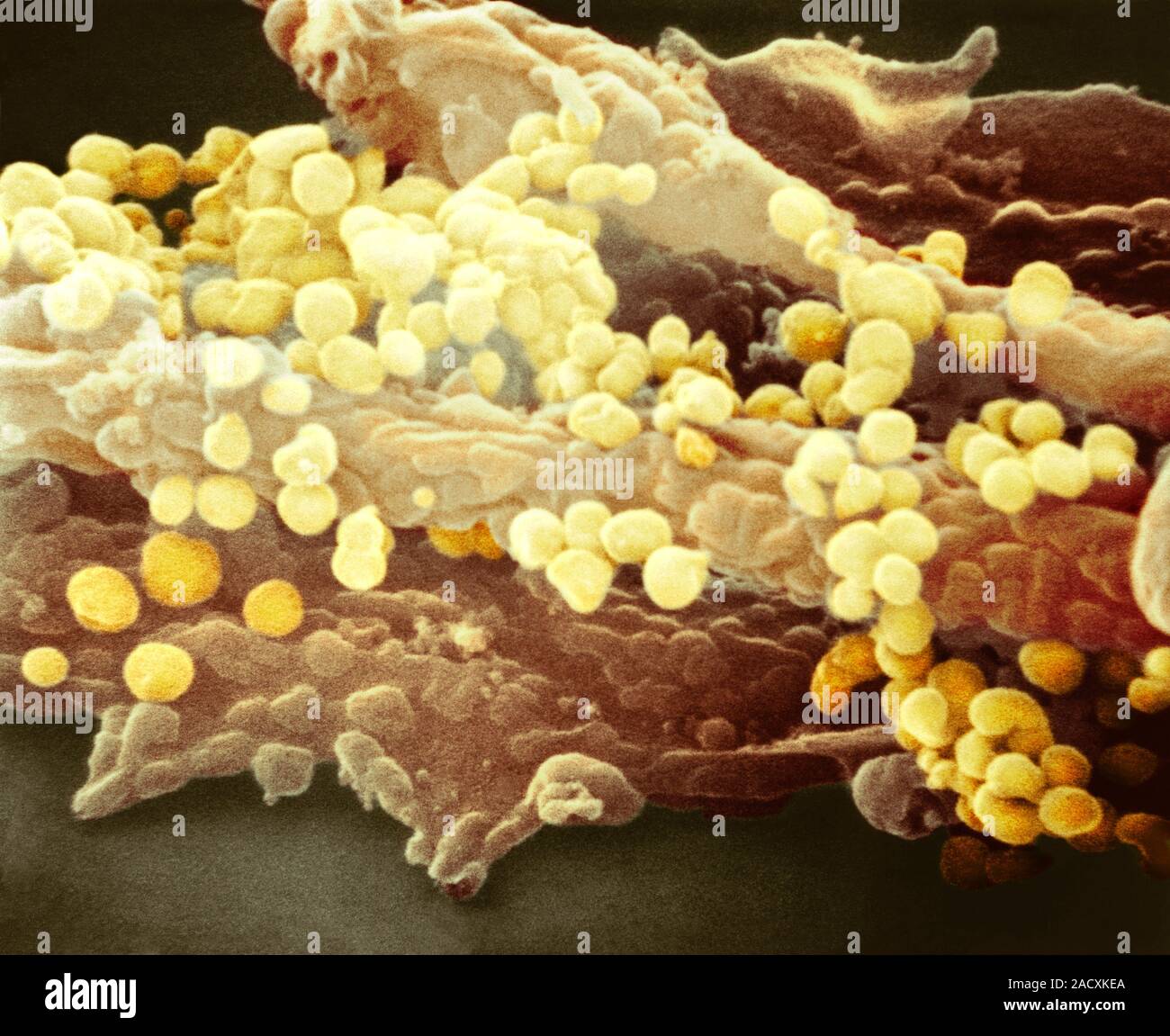 H1N1 flu virus particles (round) on a cell membrane, coloured scanning ...
