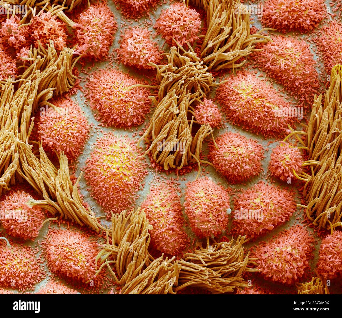 Fallopian tube. Coloured scanning electron micrograph (SEM) of the ...