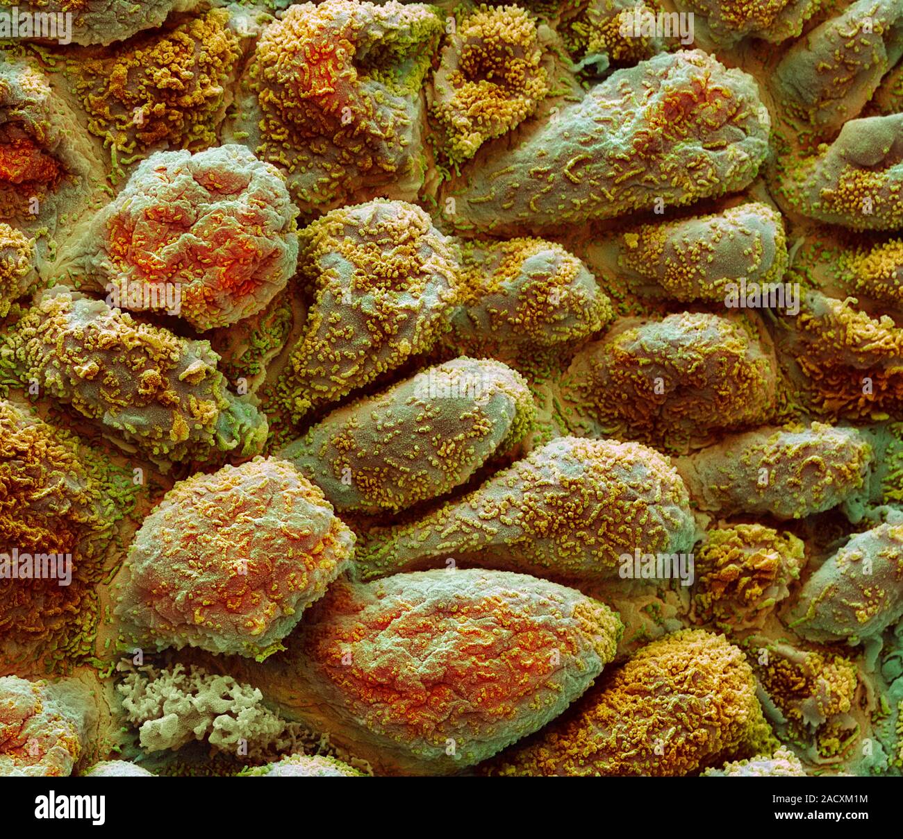 Post menopausal uterus. Coloured scanning electron micrograph (SEM) of ...