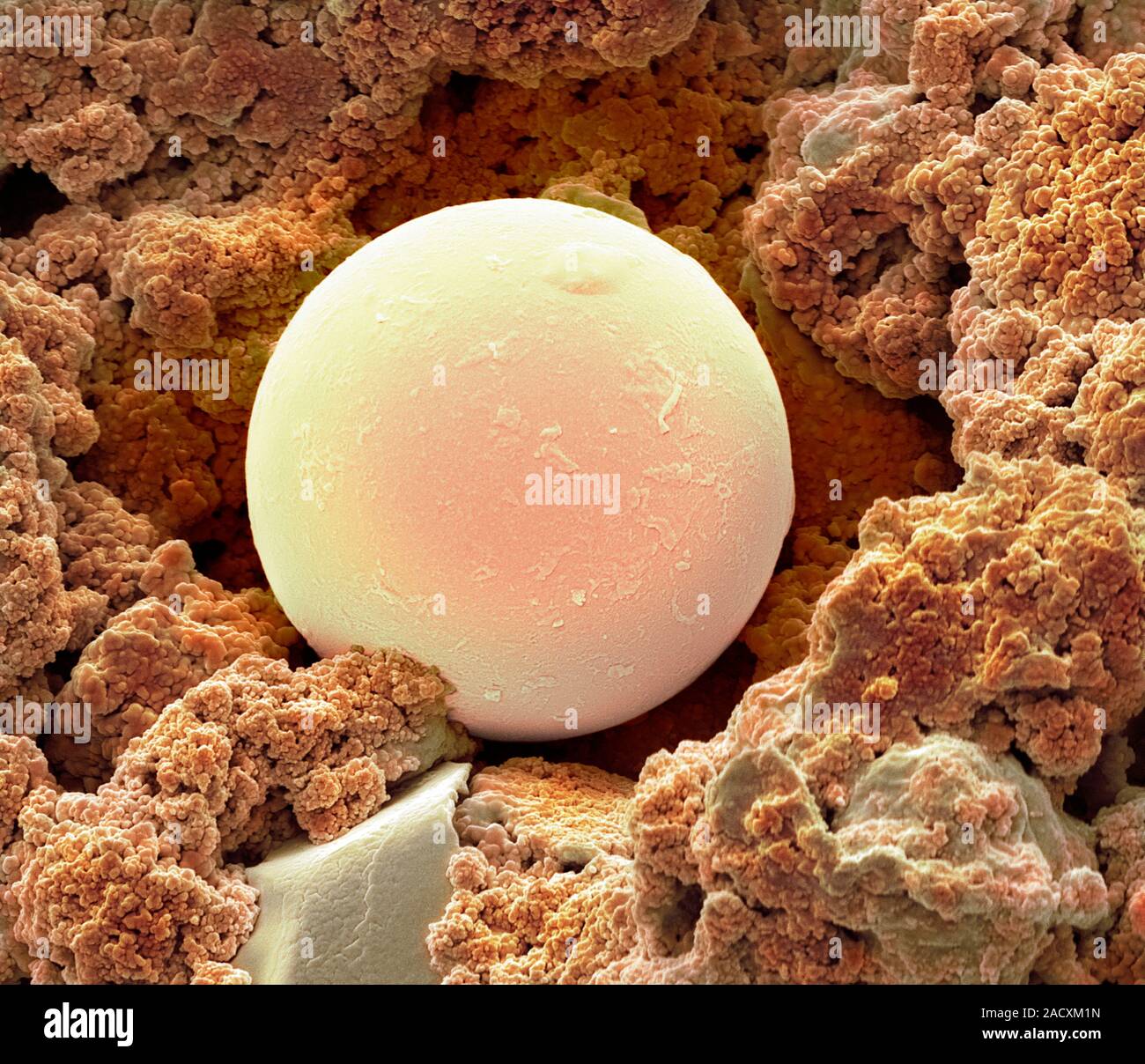 Sunscreen microsphere, coloured scanning electron micrograph (SEM ...