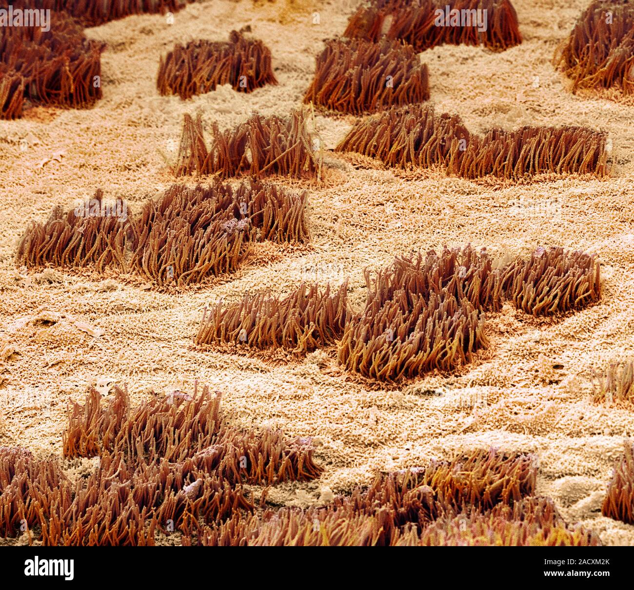 Uterus (mid-secretory stage). Coloured scanning electron micrograph ...
