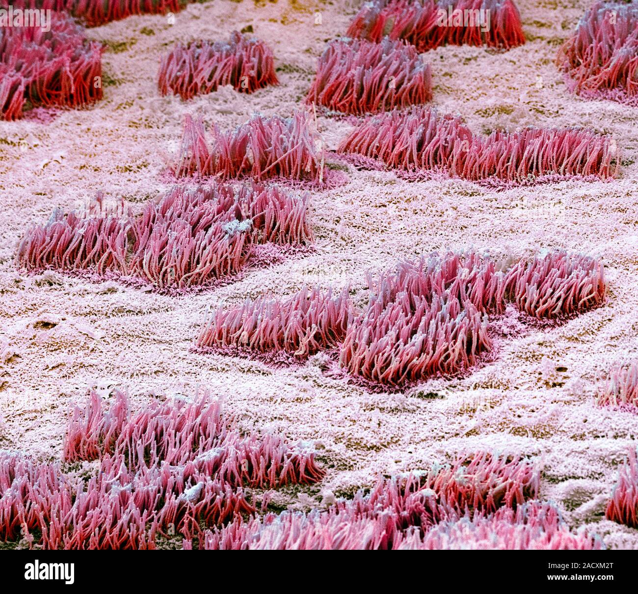 Uterus (mid-secretory stage). Coloured scanning electron micrograph ...