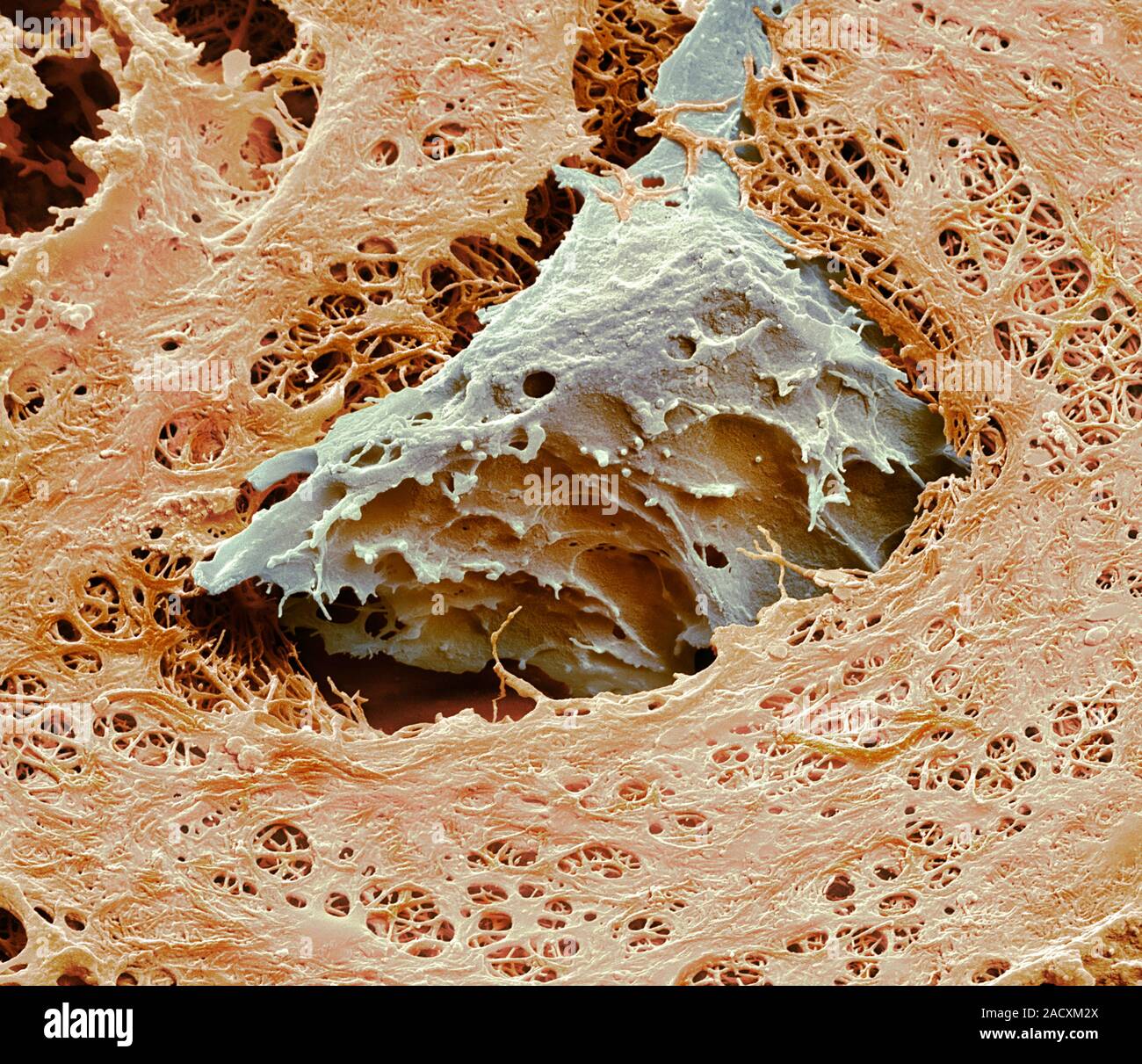 Nasal cartilage. Coloured scanning electron micrograph (SEM) of a ...