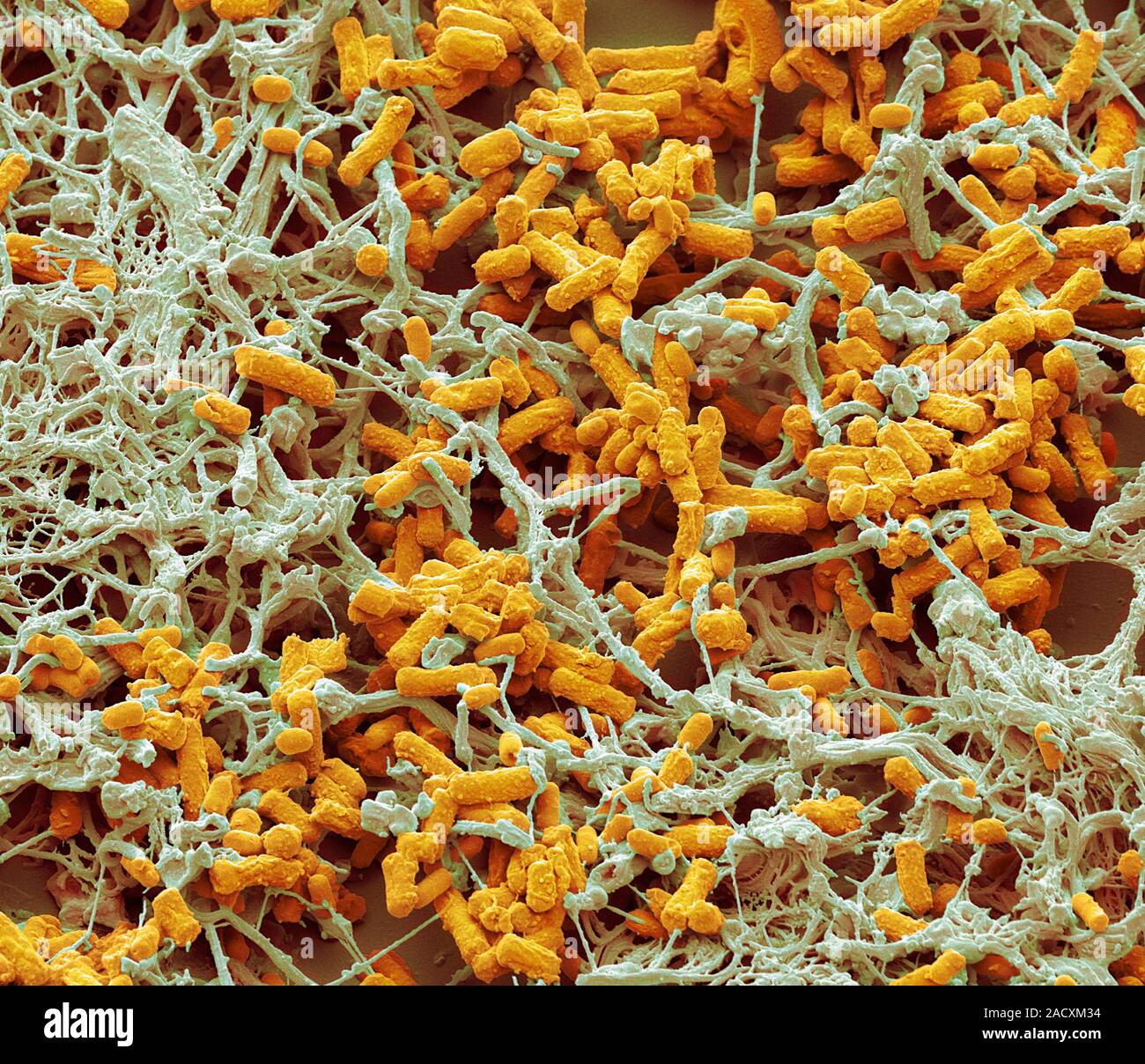 Colitis. Coloured scanning electron micrograph (SEM) of bacterial ...