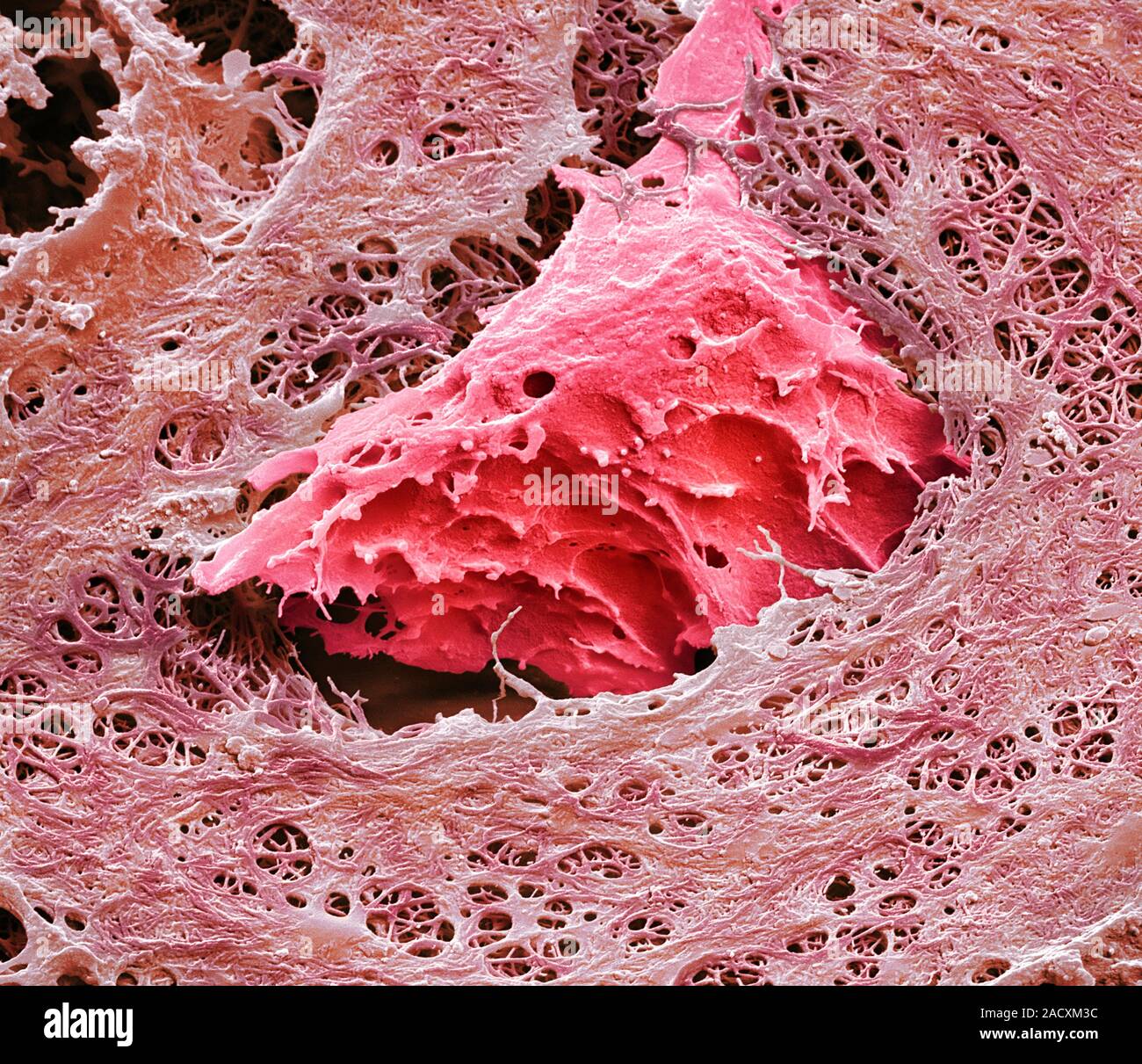 Nasal cartilage. Coloured scanning electron micrograph (SEM) of a ...
