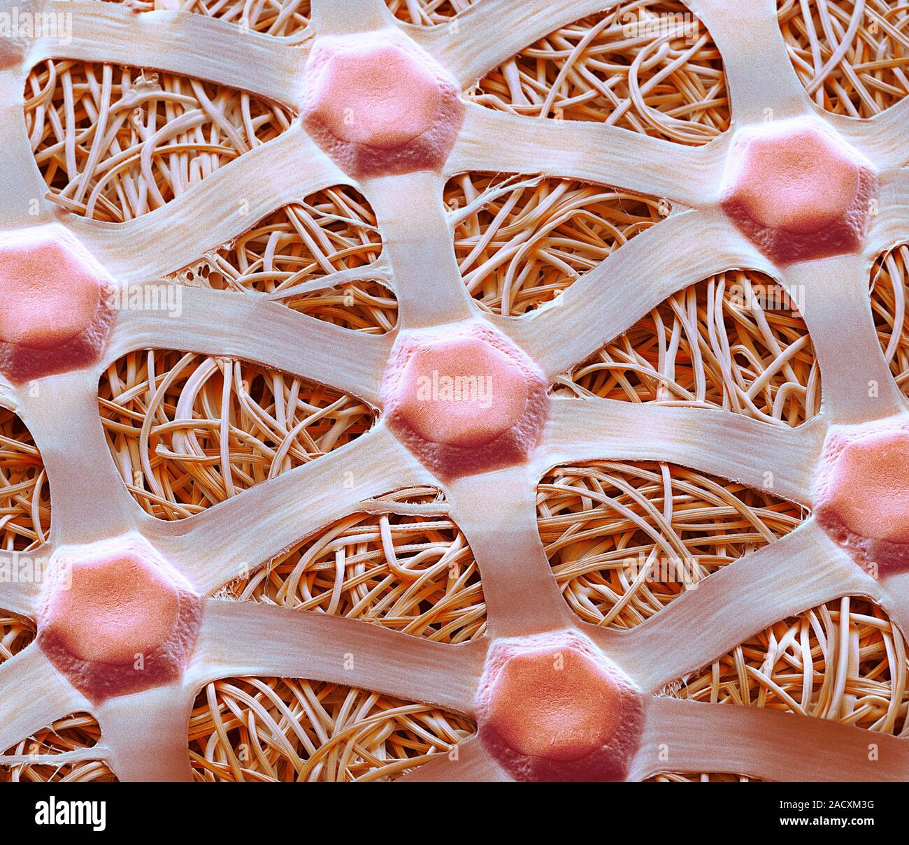 Silver plaster technology, coloured electron micrograph (SEM). Nano ...