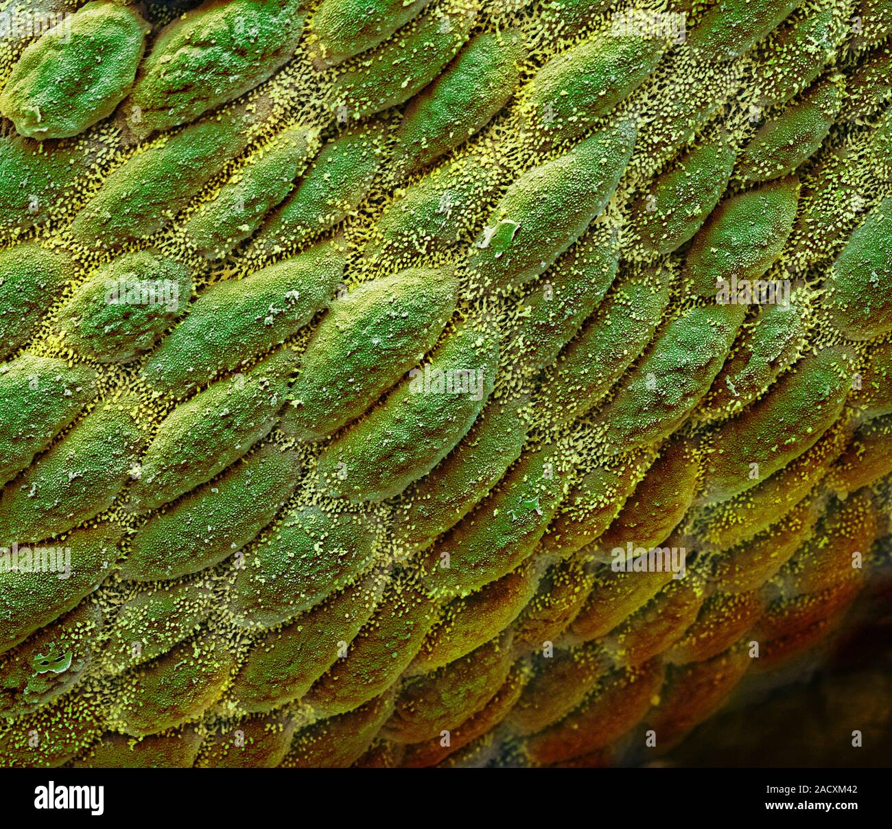 Colon. Coloured scanning electron micrograph (SEM) of the surface of ...