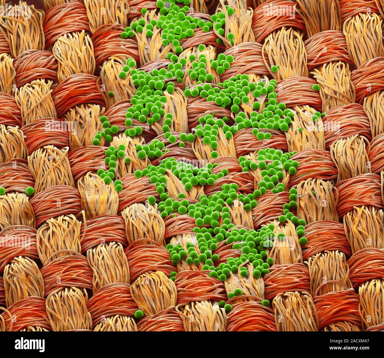 Retroreflective beads, coloured electron micrograph (SEM ...