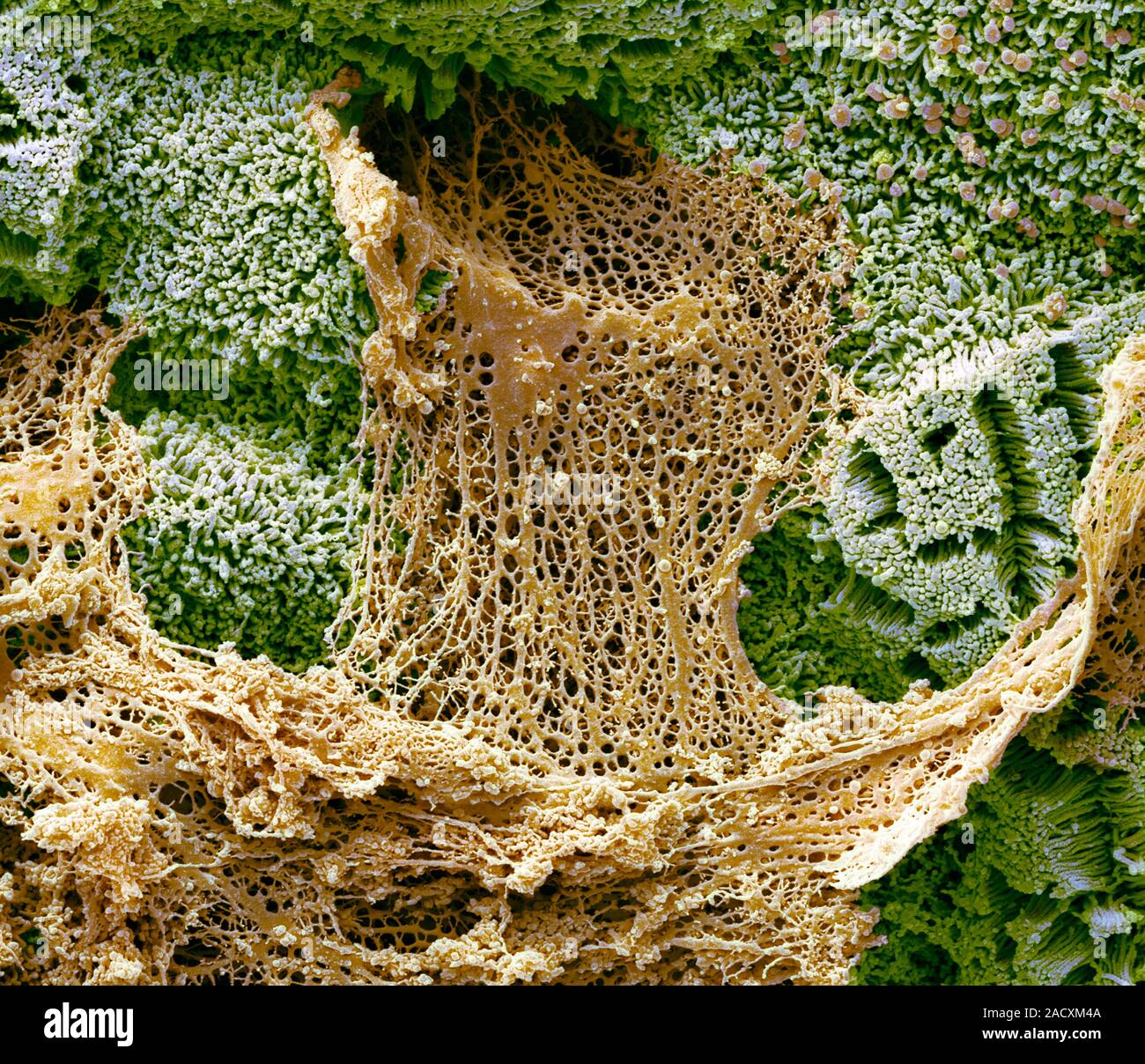 Mucin secretion in the small gut, coloured electron micrograph (SEM ...