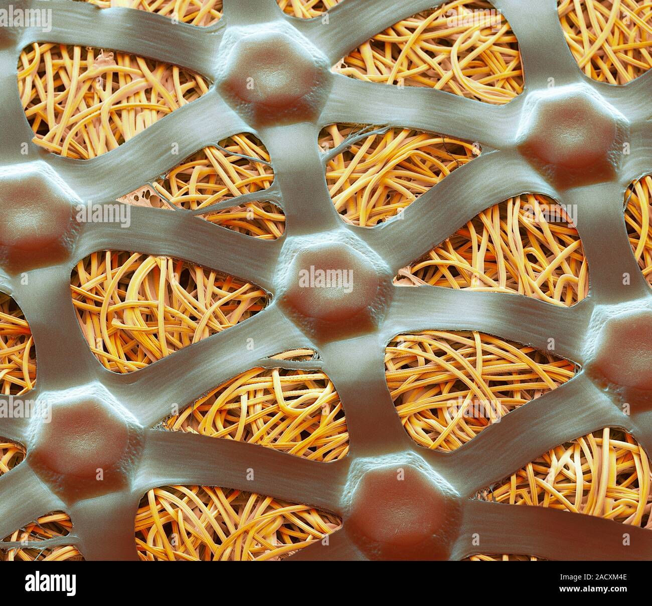 Silver plaster technology, coloured electron micrograph (SEM). Nano ...
