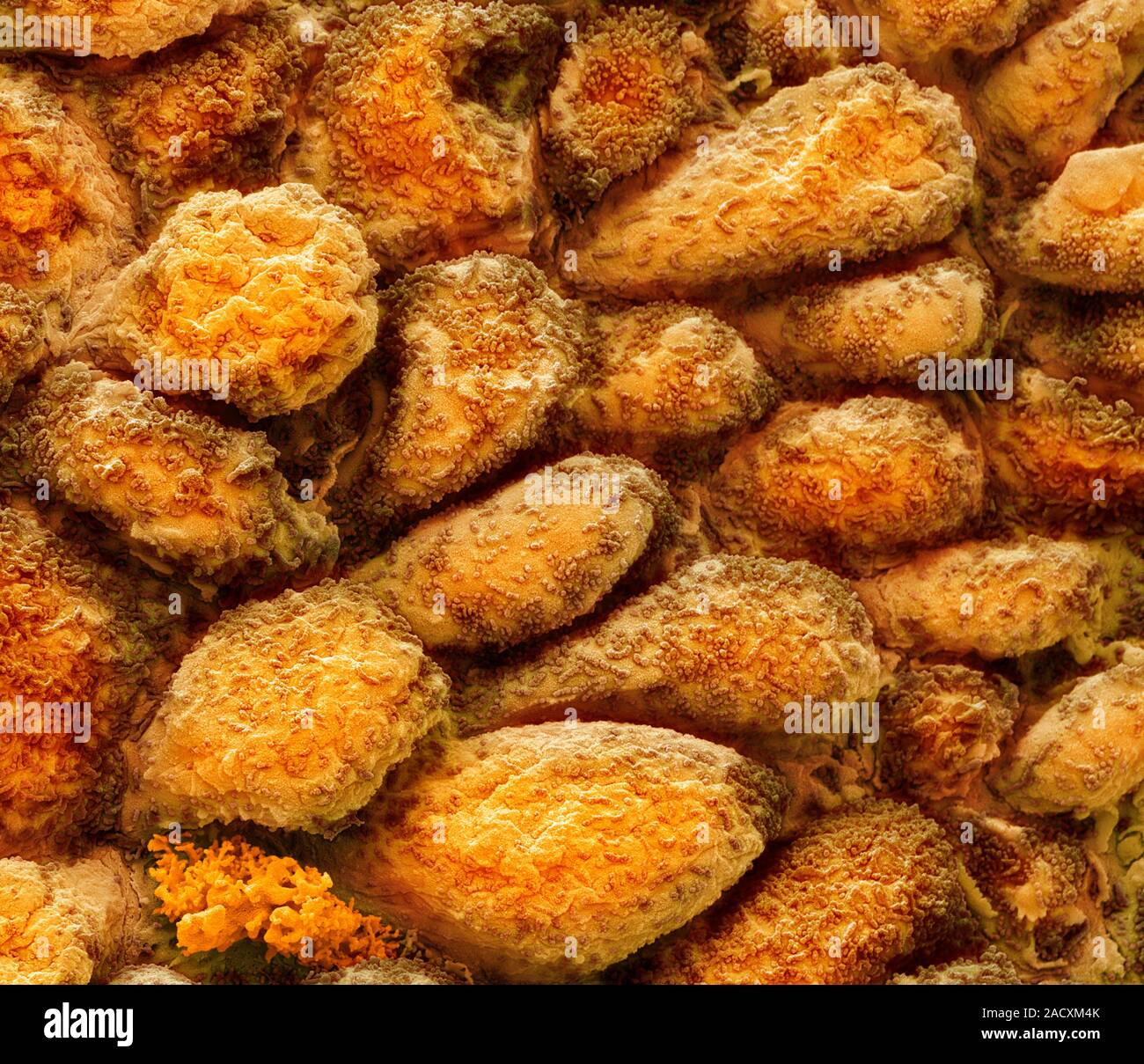 Post menopausal uterus. Coloured scanning electron micrograph (SEM) of ...