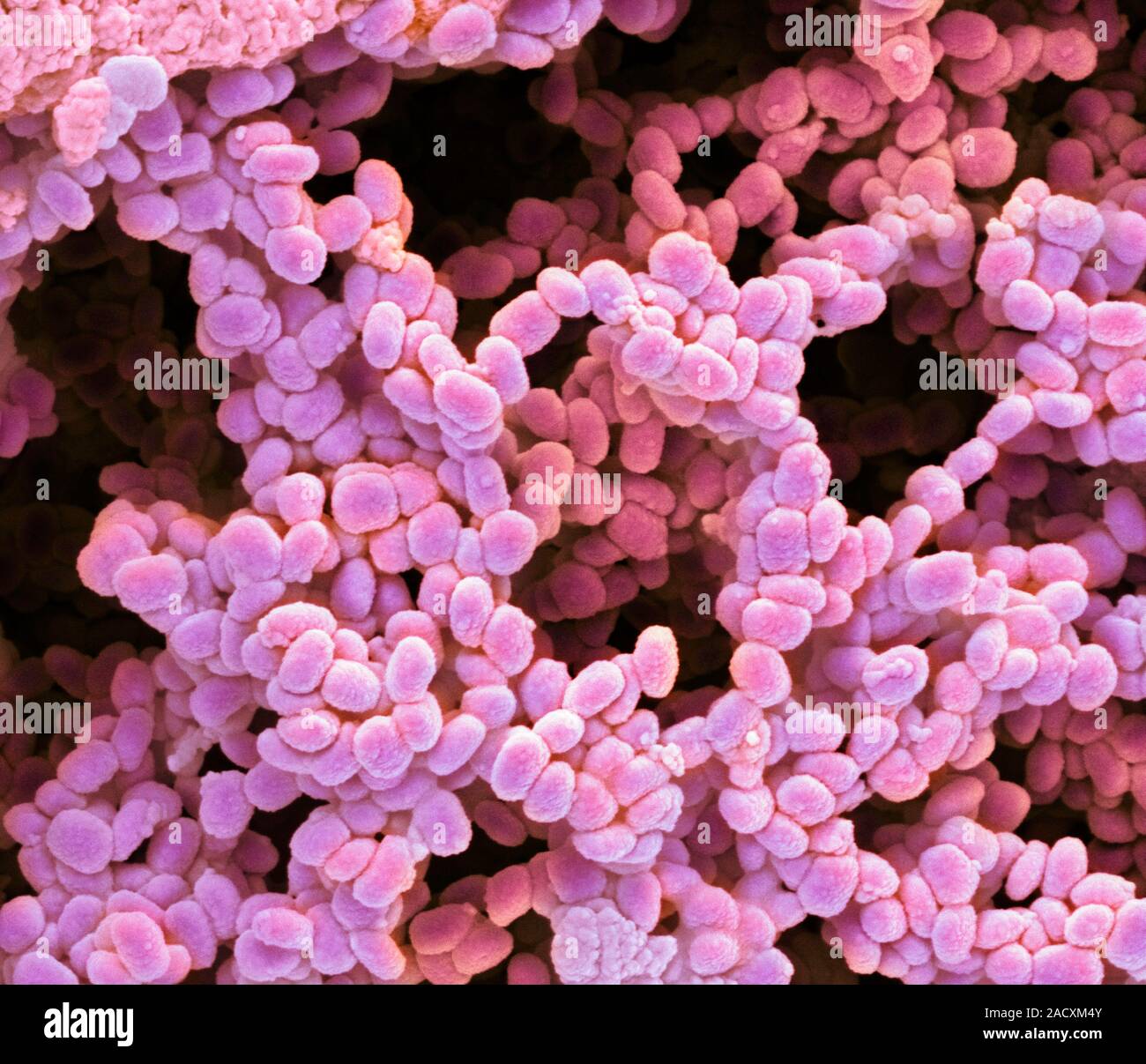 Pox virus, coloured electron micrograph (SEM) of Molluscum contagiosum ...