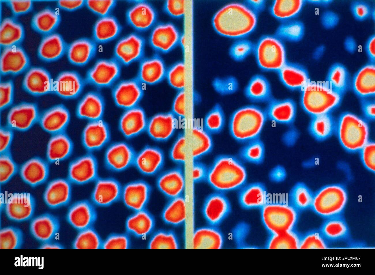 Silicon atoms, coloured scanning tunnelling micrograph (STM). This is ...